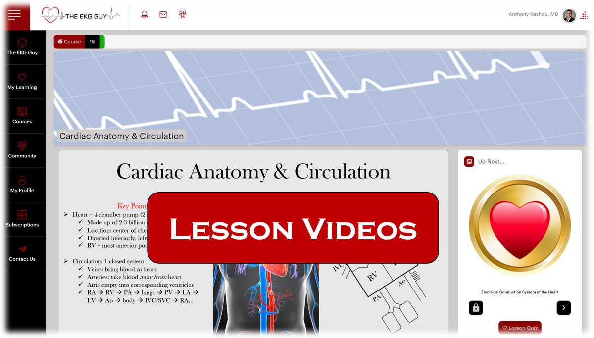 Online EKG Course – The EKG Guy