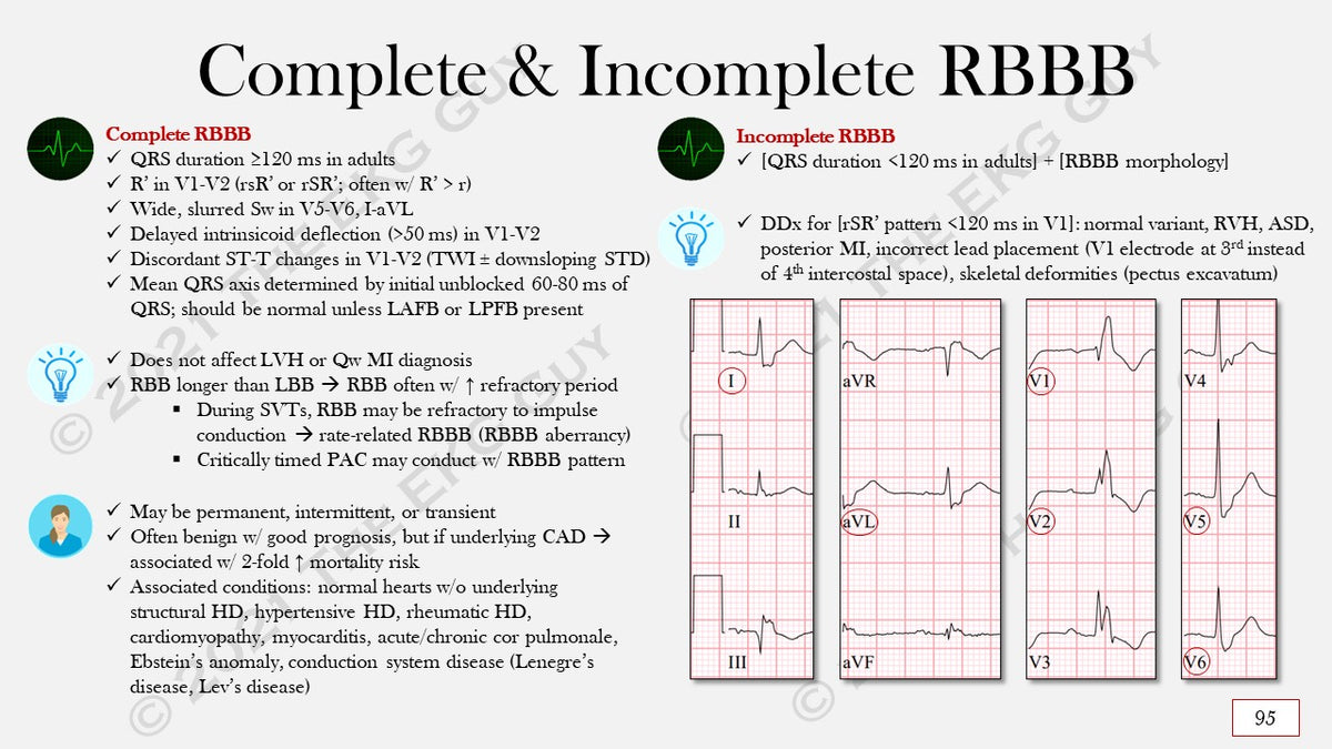 Ultimate EKG Coding Breakdown (1st Ed) – The EKG Guy